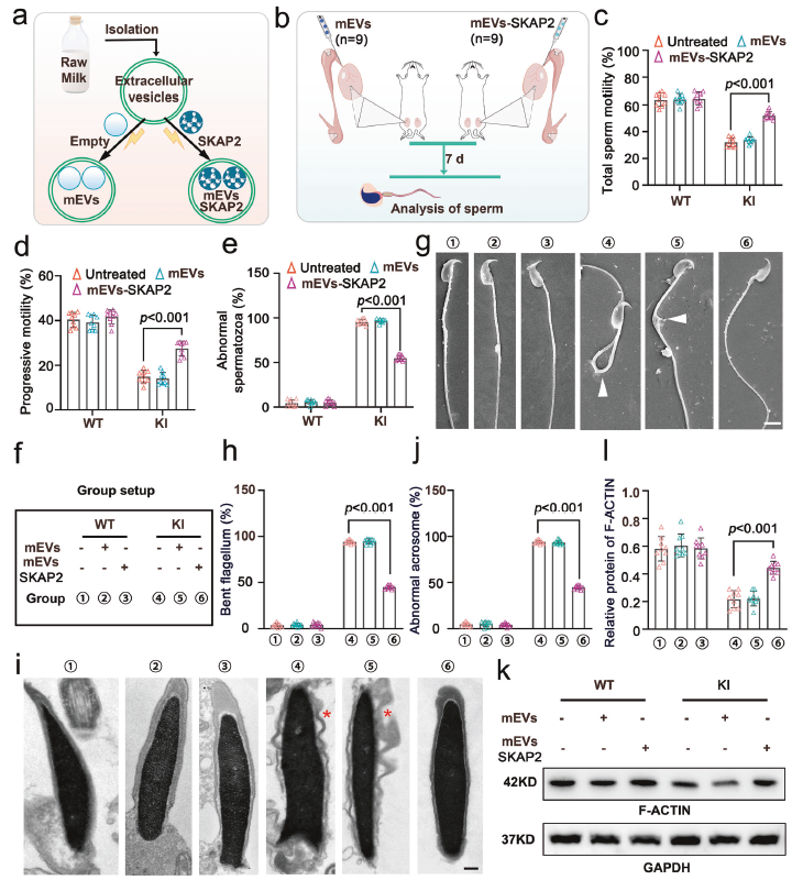 Absin Kit Powers mEVs-SKAP2 Therapy for Asthenoteratozoospermia