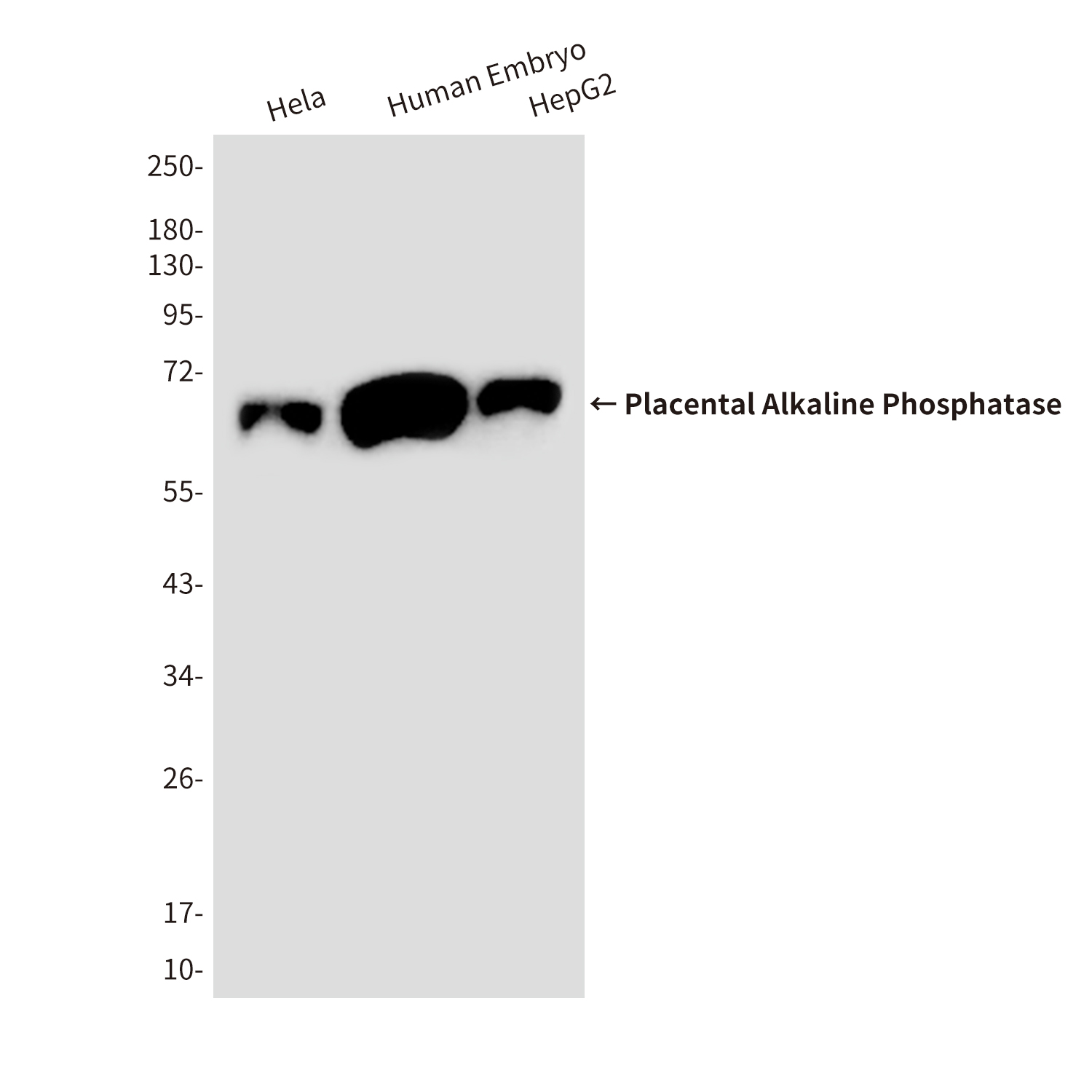 Mouse anti-Placental Alkaline Phosphatase Monoclonal Antibody-3C11 ...