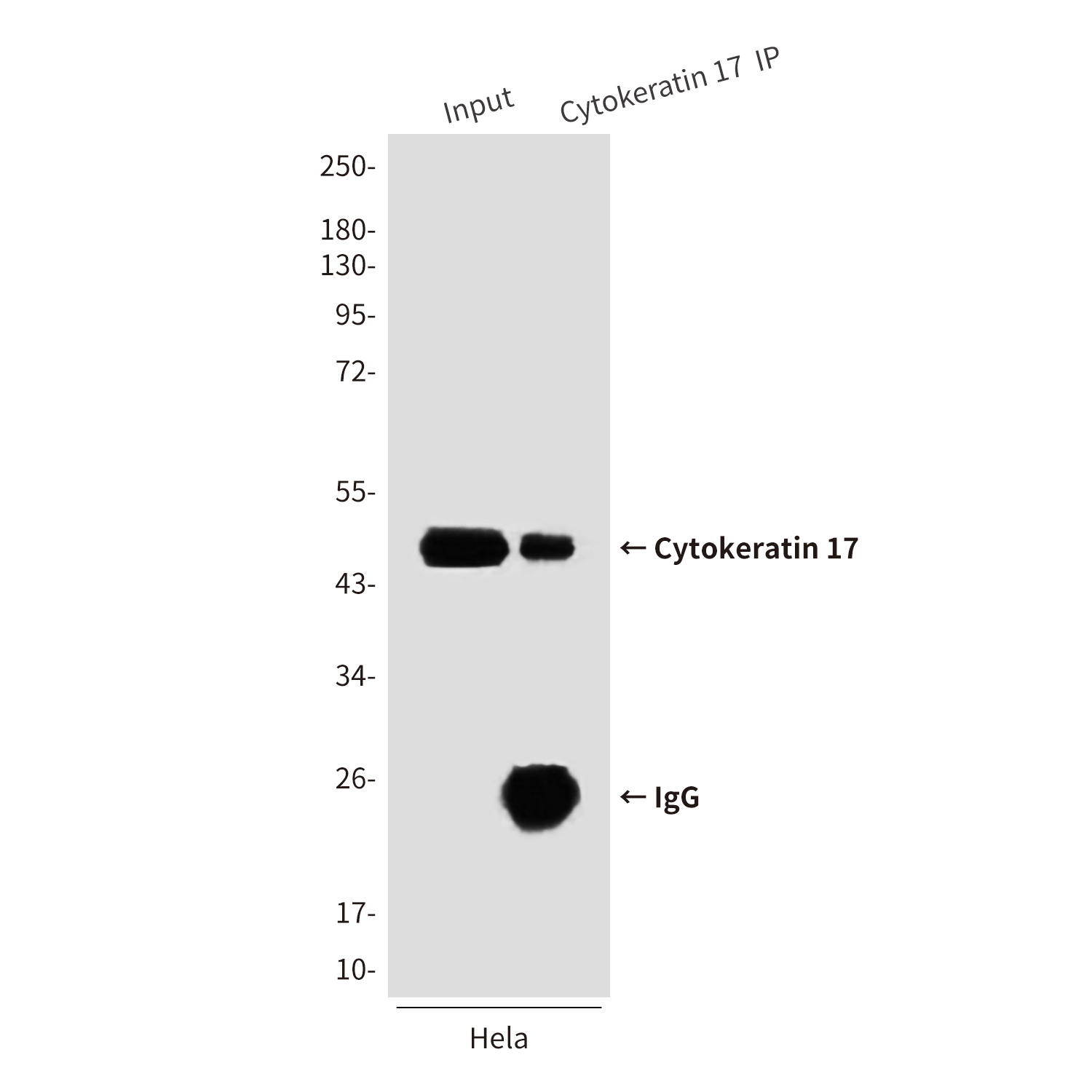 Mouse anti-Cytokeratin 17 Monoclonal Antibody(8C6)-爱必信(absin)官网
