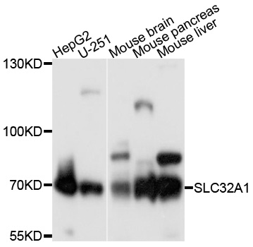 Rabbit anti-SLC32A1 Polyclonal Antibody-爱必信(absin)官网