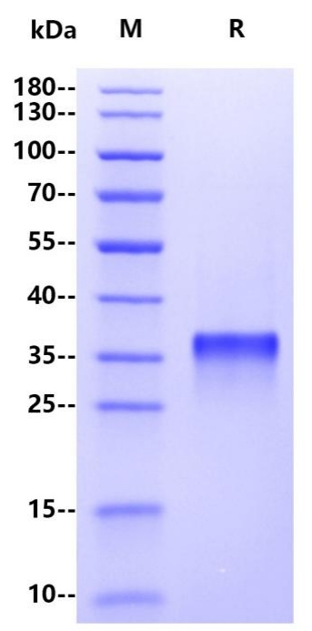 Recombinant Human PSA Protein(C-10His)-爱必信(absin)官网