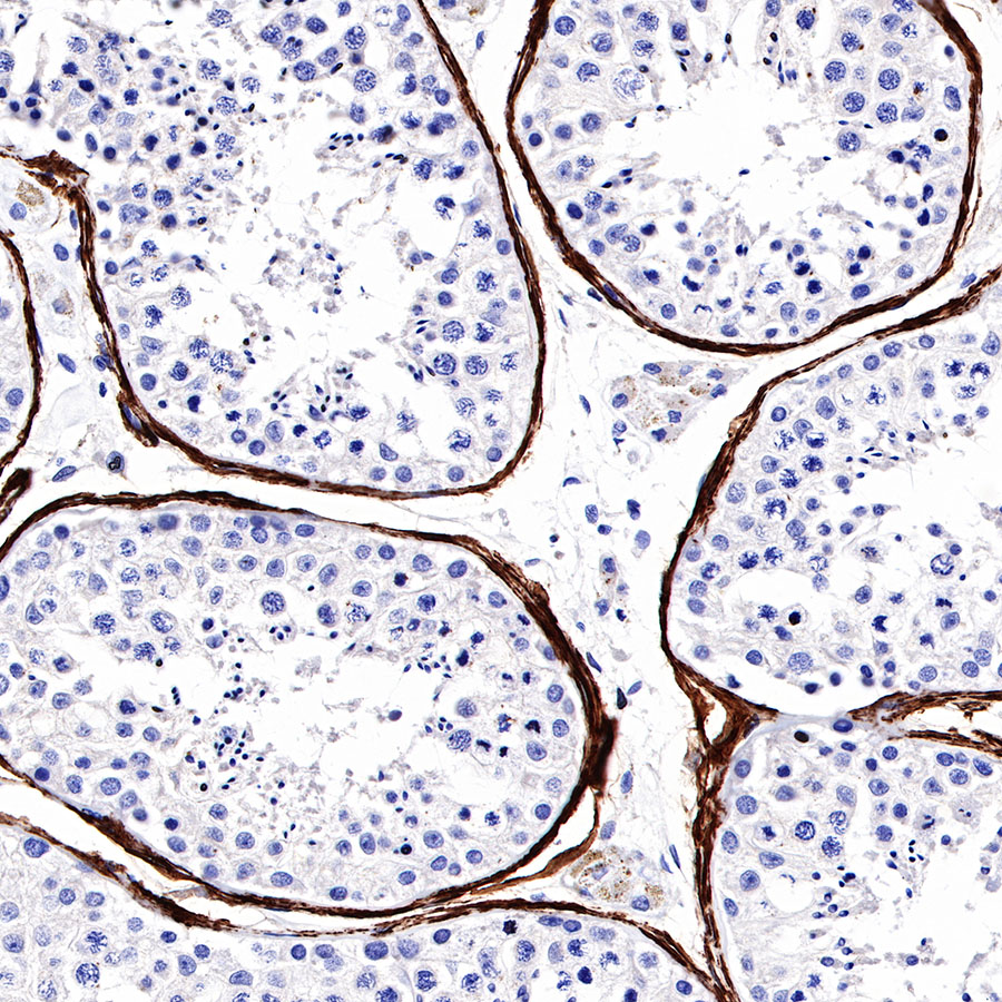 Rabbit anti- smooth muscle Actin-SMA- Recombinant Monoclonal Antibody ...