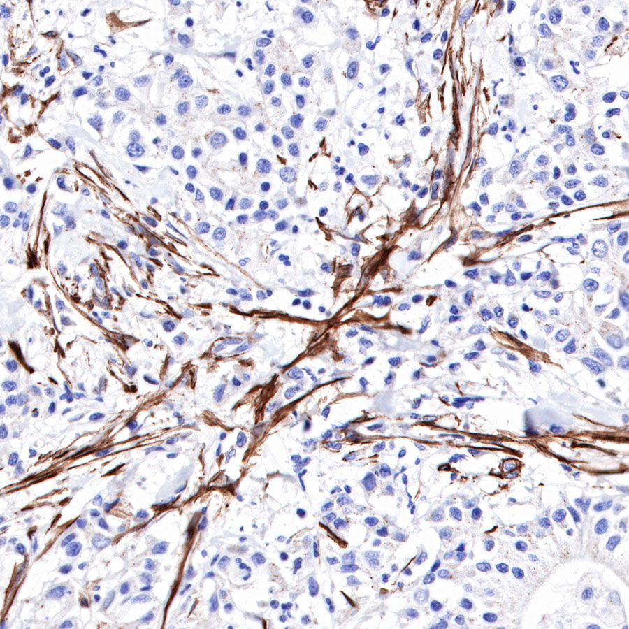 Rabbit anti- smooth muscle Actin-SMA- Recombinant Monoclonal Antibody ...