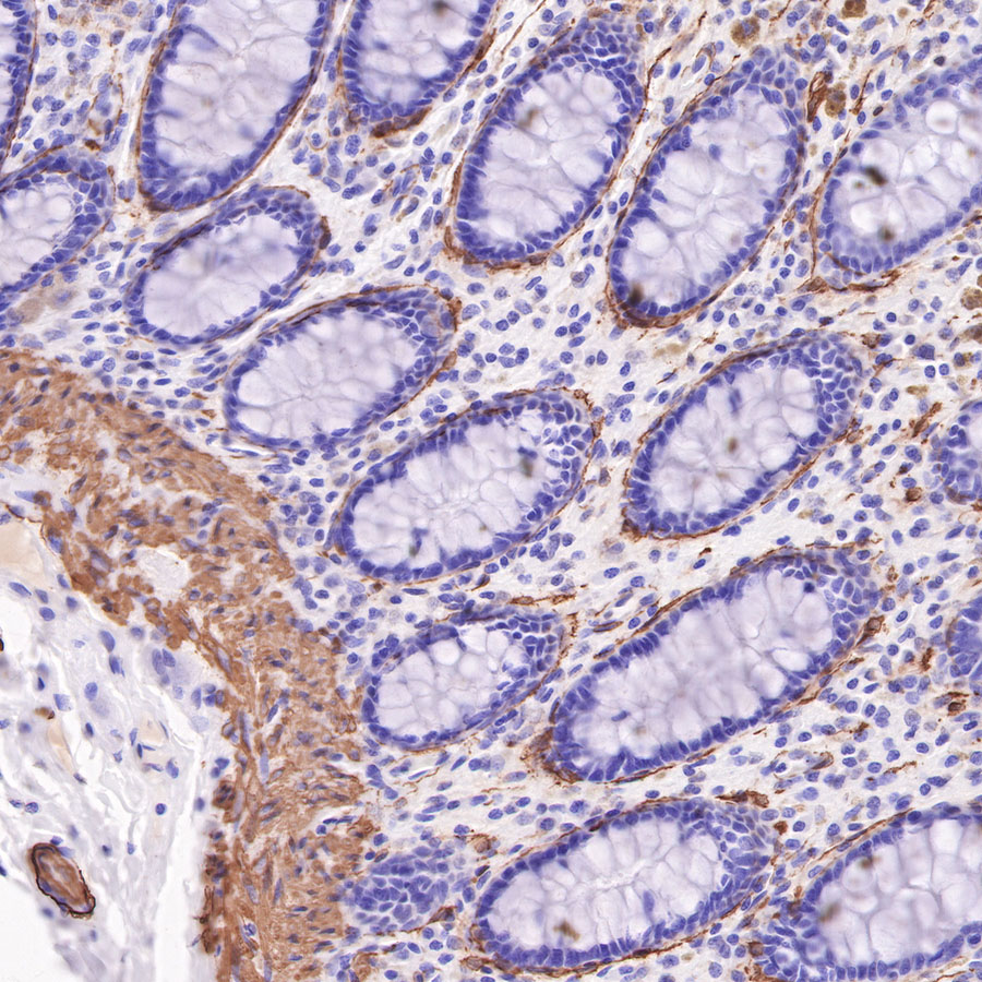 Mouse anti- Smooth Muscle Actin Recombinant Monoclonal Antibody-R142 ...