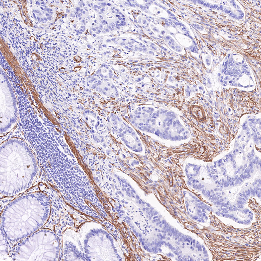 Mouse anti- Smooth Muscle Actin Recombinant Monoclonal Antibody-R142 ...