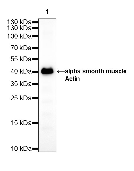 Mouse anti- Smooth Muscle Actin Recombinant Monoclonal Antibody-R142 ...