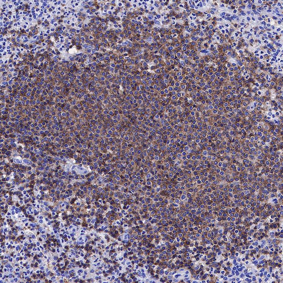 Mouse anti-CD45 Monoclonal Antibody-429-1_Absin_优宁维(univ)商城