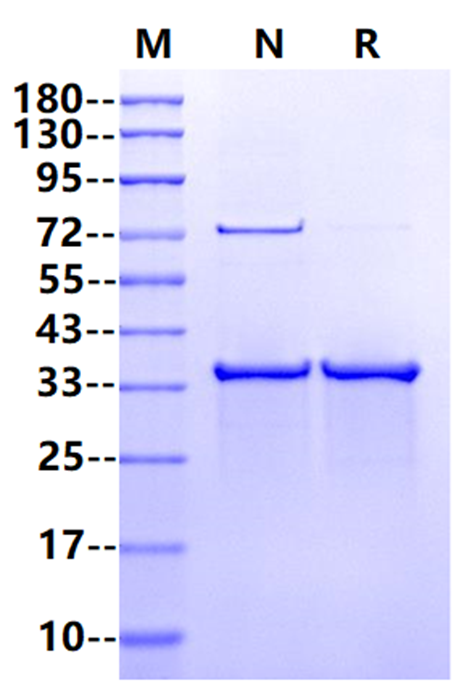 Recombinant Streptococcus Pyogenes IdeS Protease-His Tag_Absin_优宁维(univ)商城