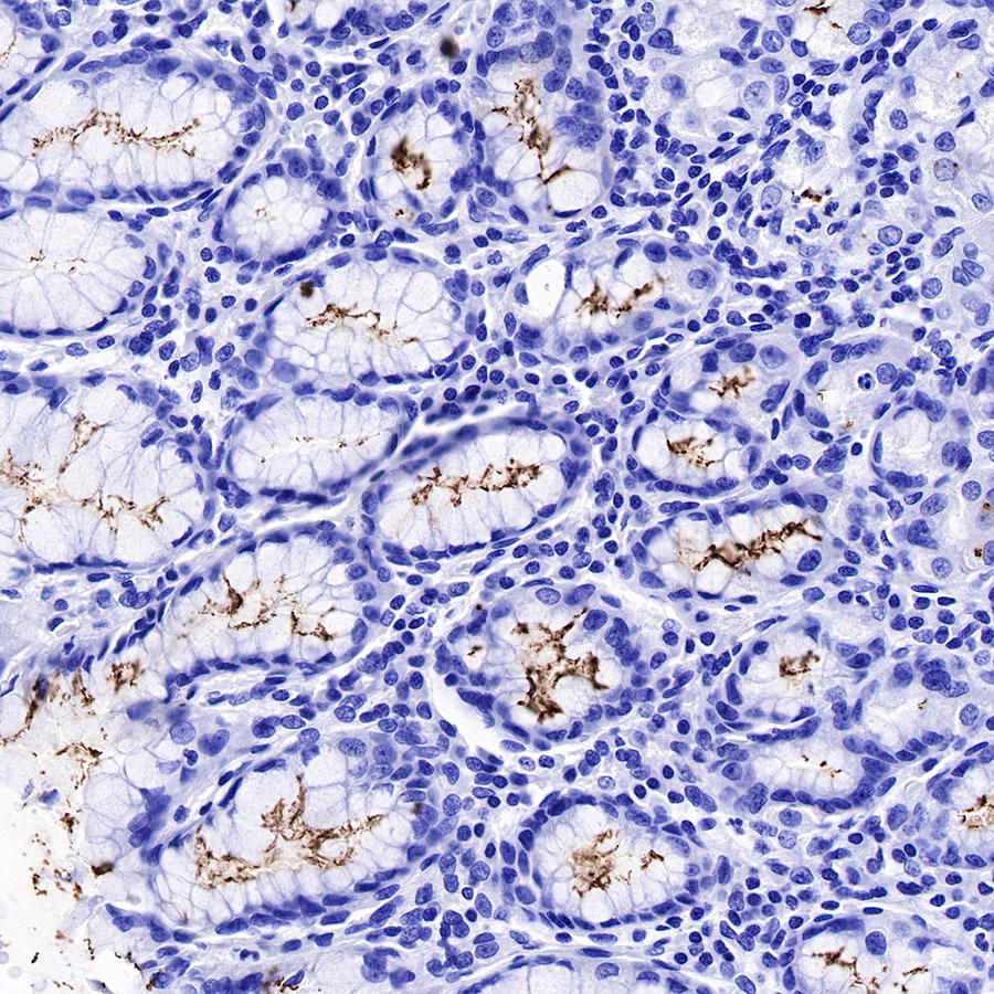 Rabbit anti-Helicobacter Pylori Recombinant Monoclonal Antibody-R273 ...