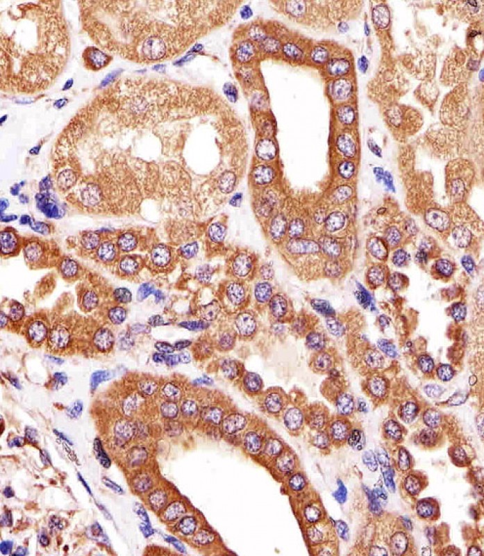 Tool Box for Life Science | Biochemicals-Absin