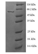 Recombinant Human CYP21A2 Protein -N-terminal 6xHis-爱必信(absin)官网
