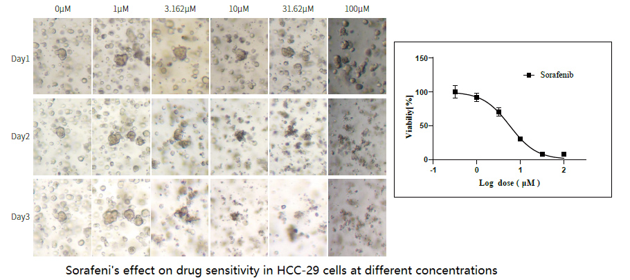 Organoid Drug Sensitivity Testing Partial Results Display ...